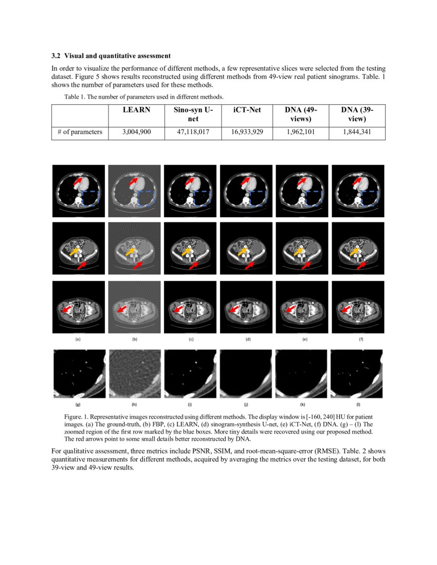 Dual Network Architecture for Few-view CT --Trained on ImageNet Data ...
