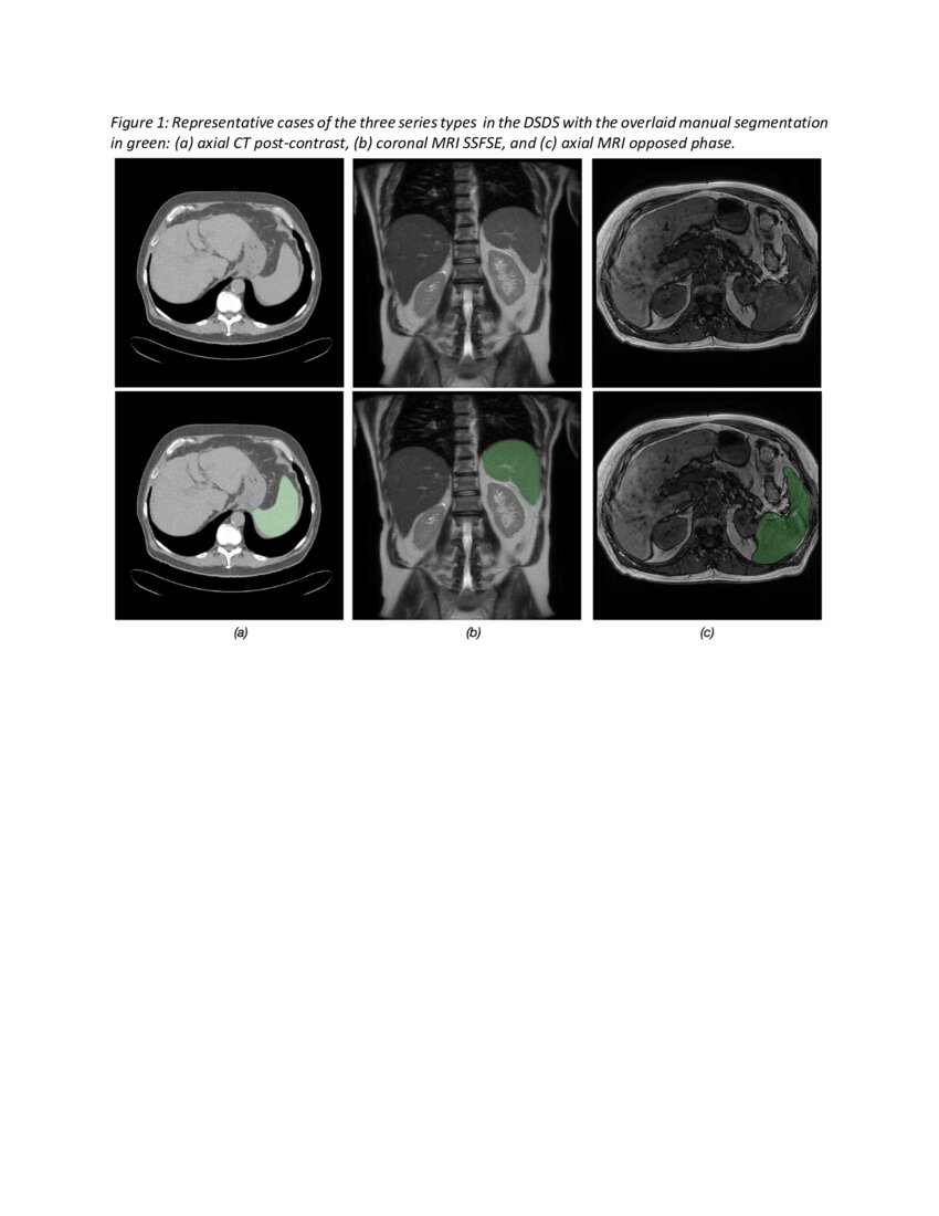 Duke Spleen Data Set: A Publicly Available Spleen MRI and CT dataset for Training Segmentation ...