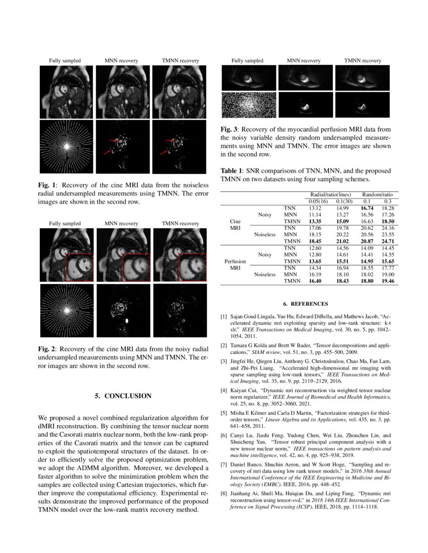 Dynamic Cardiac Mri Reconstruction Using Combined Tensor Nuclear Norm And Casorati Matrix
