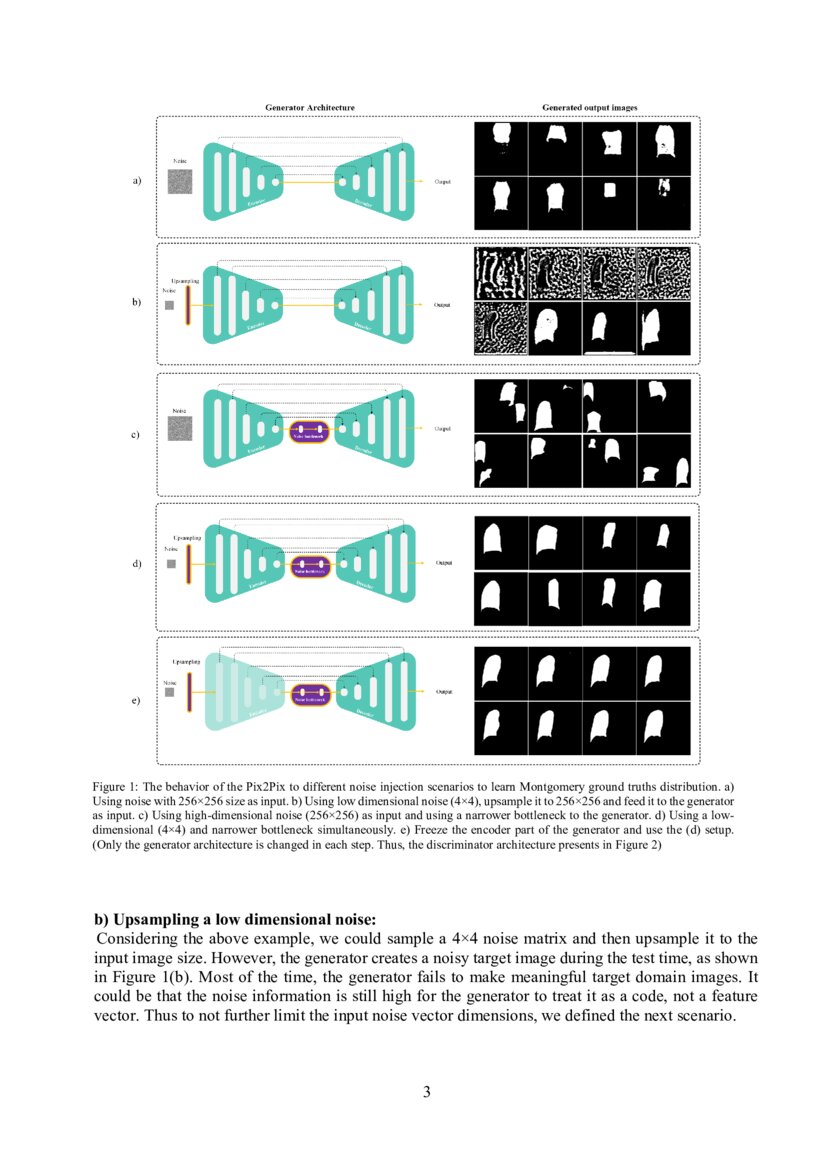 Dynamic Pix2pix Noise Injected Cgan For Modeling Input And Target Domain Joint Distributions