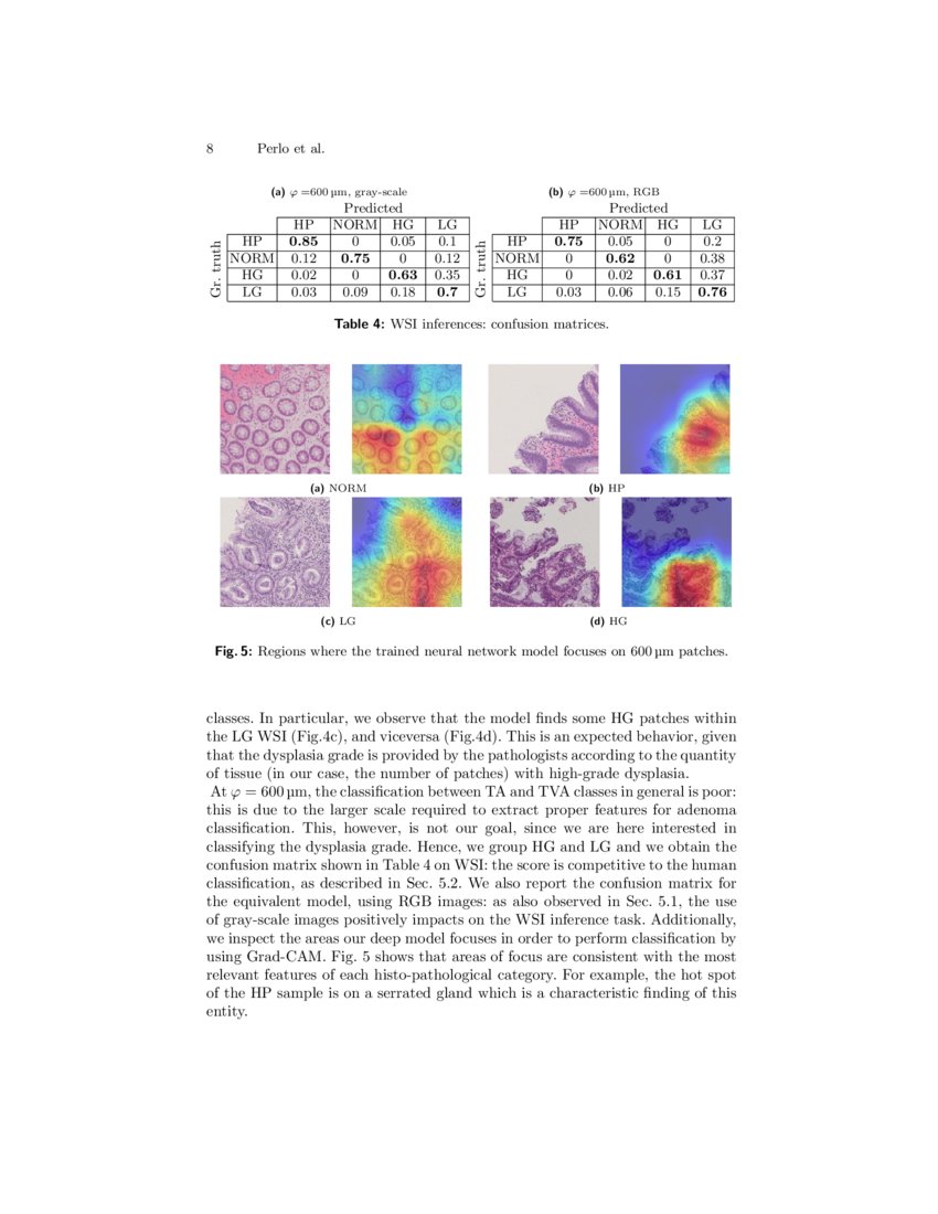 Dysplasia grading of colorectal polyps through CNN analysis of WSI | DeepAI