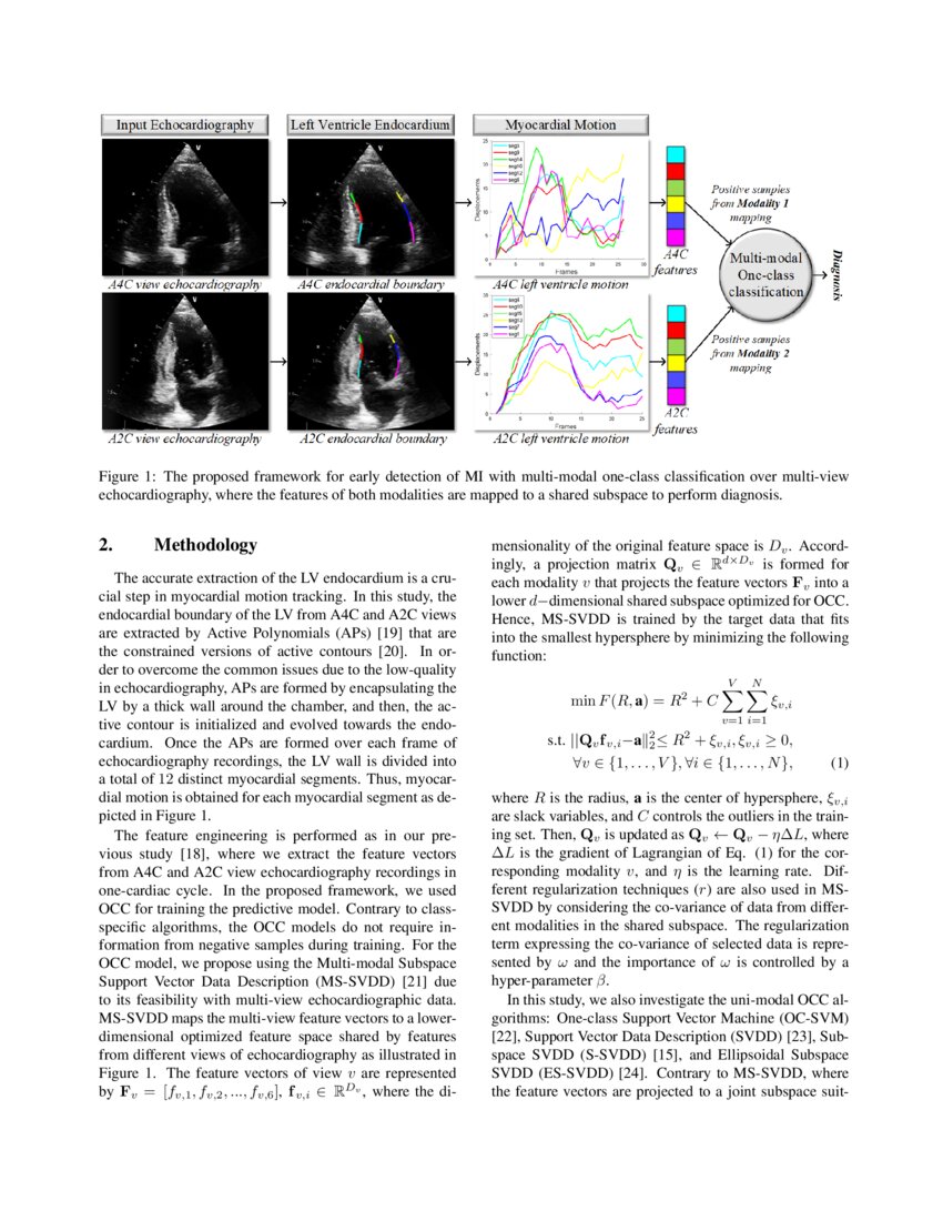 Early Myocardial Infarction Detection With One Class Classification Over Multi View
