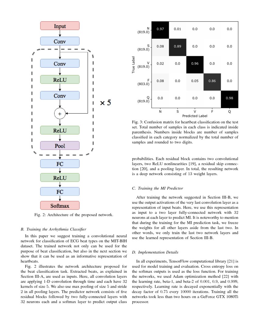 ECG Heartbeat Classification: A Deep Transferable Representation | DeepAI