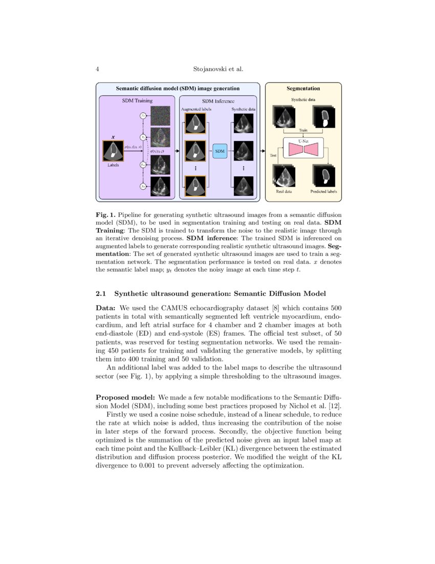 Echo from noise: synthetic ultrasound image generation using diffusion models for real image ...