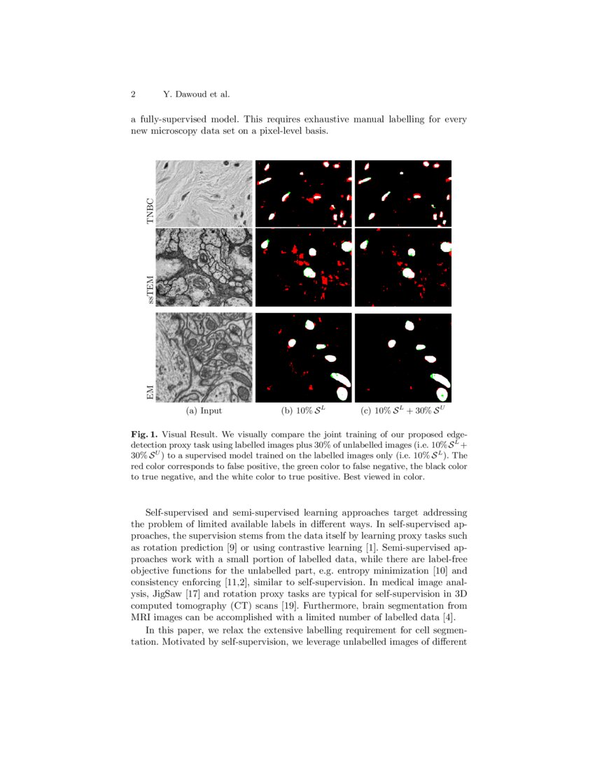 Edge-Based Self-Supervision for Semi-Supervised Few-Shot Microscopy Image Cell Segmentation | DeepAI
