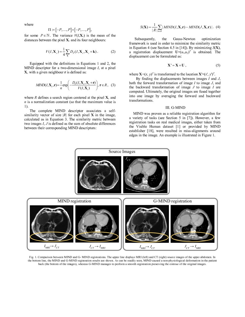 Edge Preserving Multi-Modal Registration Based On Gradient Intensity Self-Similarity | DeepAI