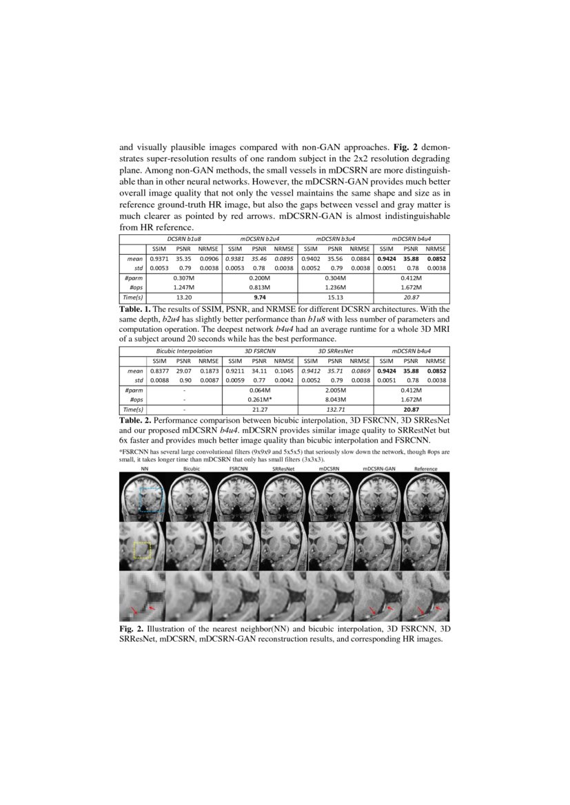 Efficient And Accurate Mri Super Resolution Using A Generative