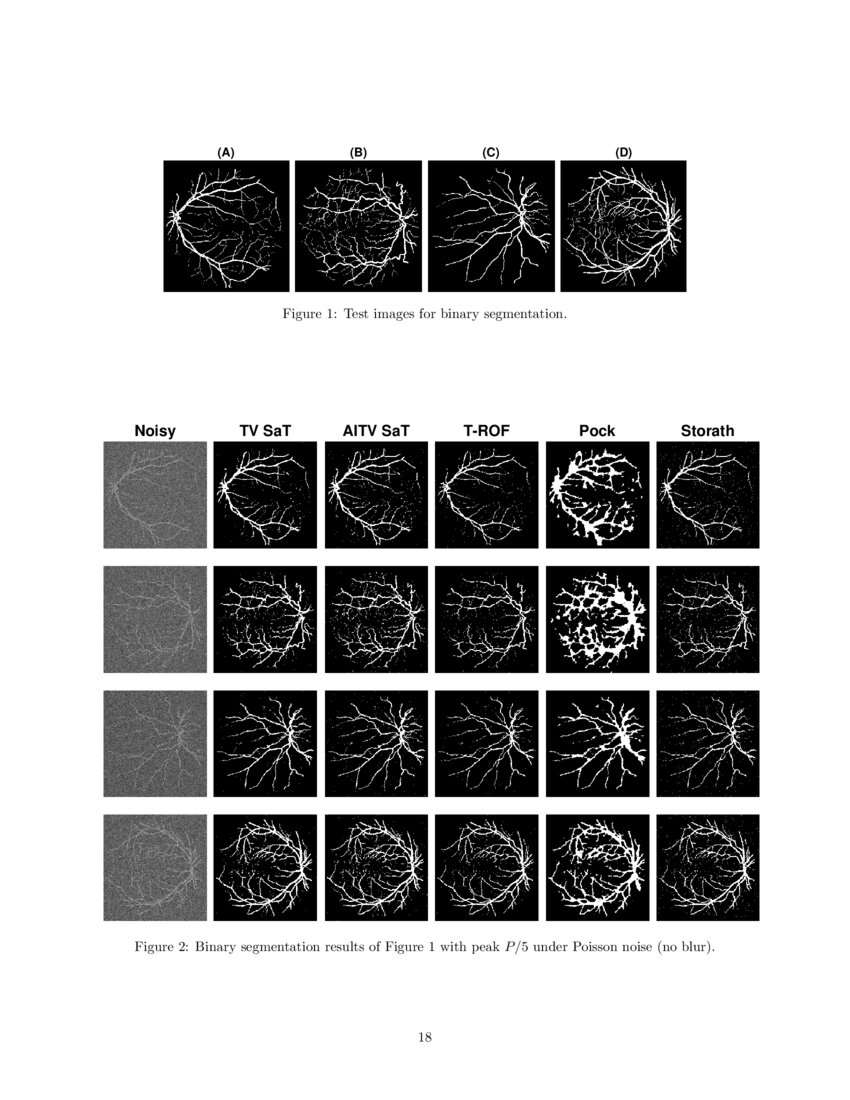Efficient Image Segmentation Framework With Difference Of Anisotropic And Isotropic Total