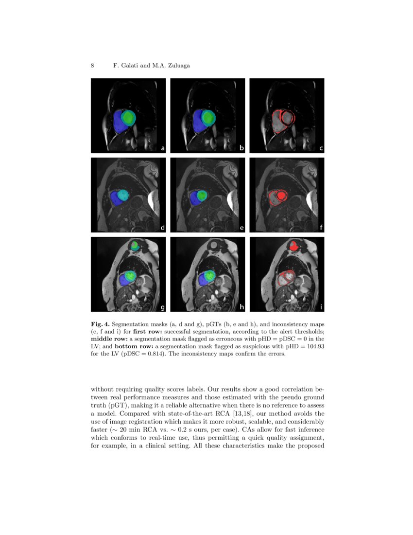Efficient Model Monitoring for Quality Control in Cardiac Image ...