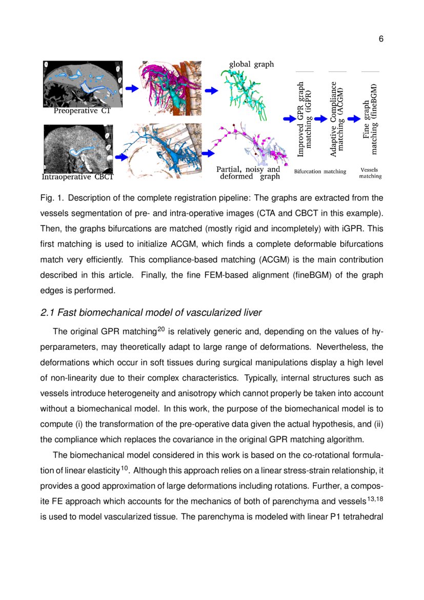 Elastic registration based on compliance analysis and biomechanical graph matching | DeepAI