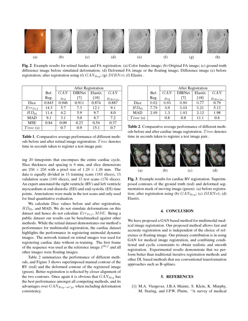 Elastic Registration of Medical Images With GANs | DeepAI
