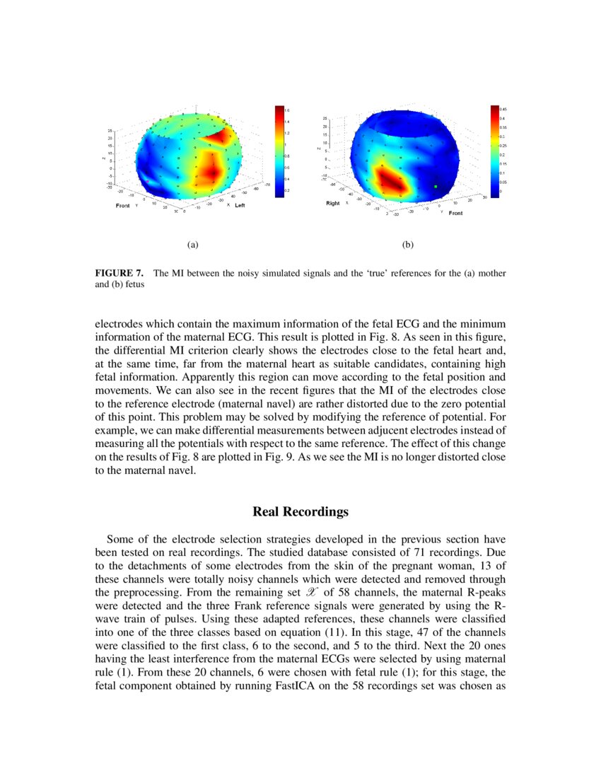 Electrode Selection for Noninvasive Fetal Electrocardiogram Extraction using Mutual Information ...