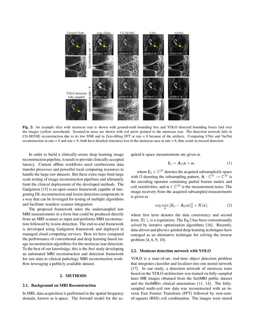 End To End Ai Based Mri Reconstruction And Lesion Detection Pipeline