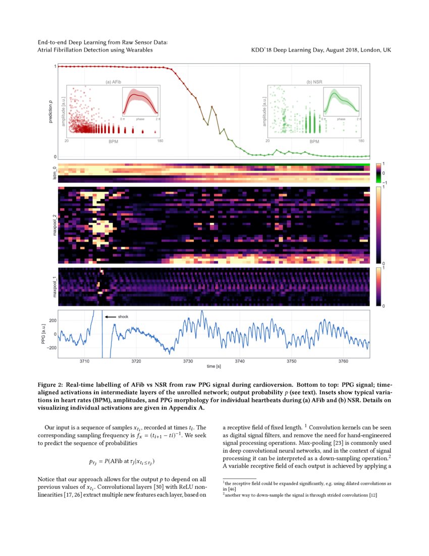 End To End Deep Learning From Raw Sensor Data Atrial Fibrillation