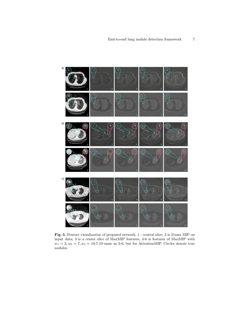 End To End Lung Nodule Detection Framework With Model Based Feature