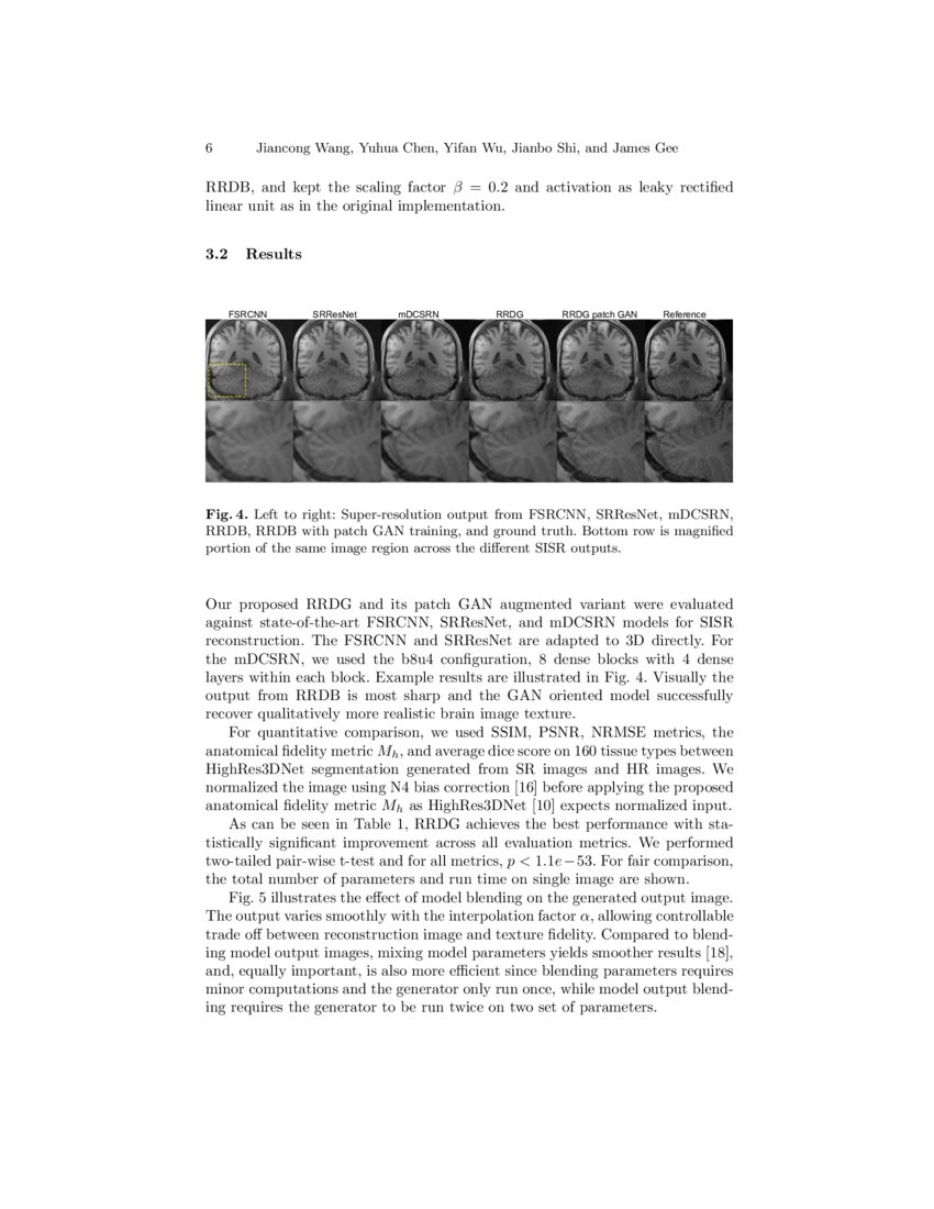 Enhanced Generative Adversarial Network For 3d Brain Mri Super Resolution Deepai