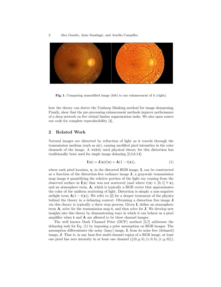 Enhancement of Retinal Fundus Images via Pixel Color Amplification | DeepAI