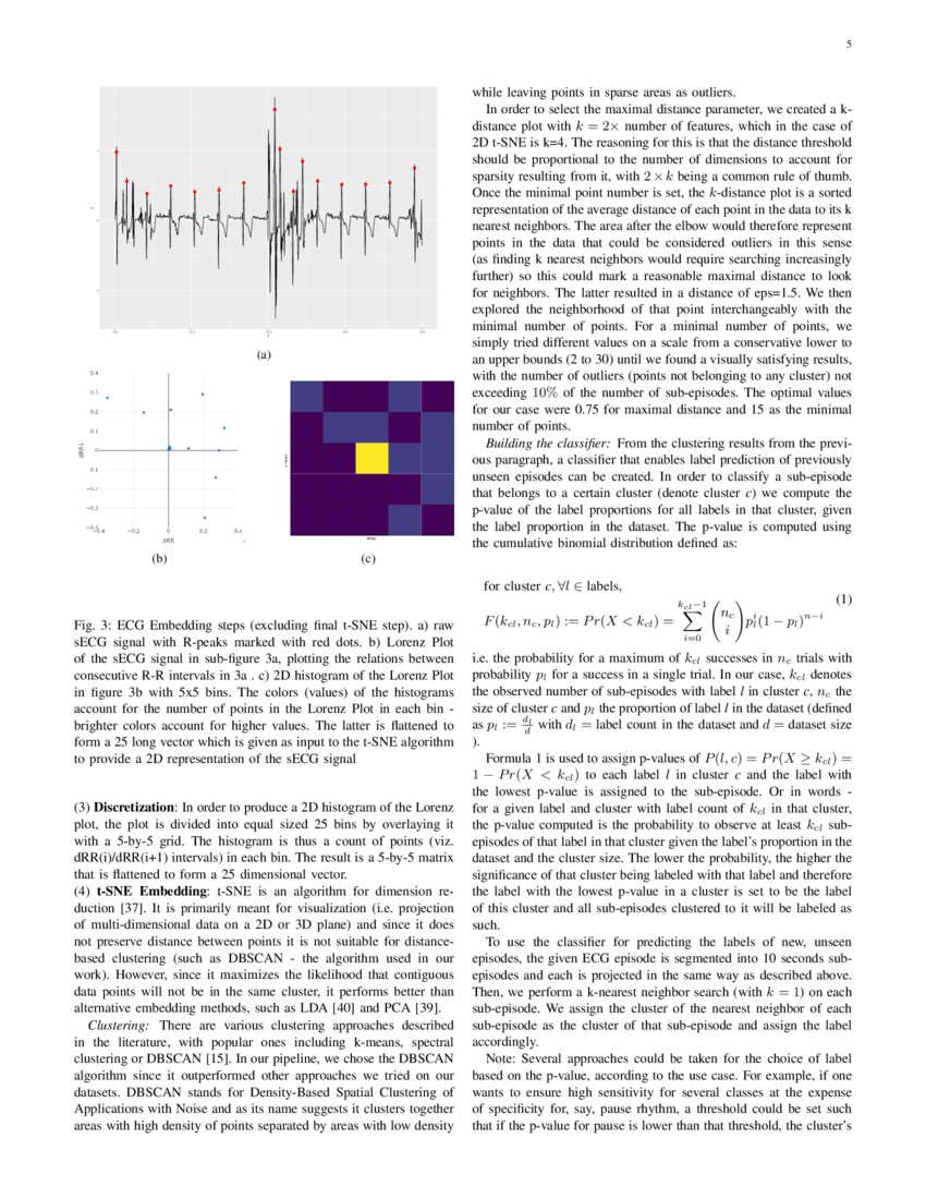 Enhancing Ecg Analysis Of Implantable Cardiac Monitor Data An Efficient Pipeline For Multi