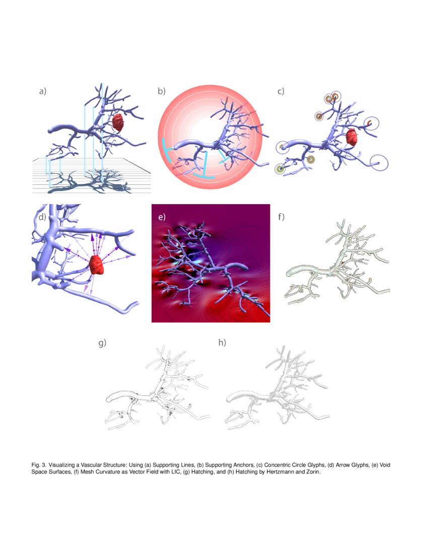 Enhancing Vascular Analysis with Distance Visualizations: An Overview and Implementation | DeepAI