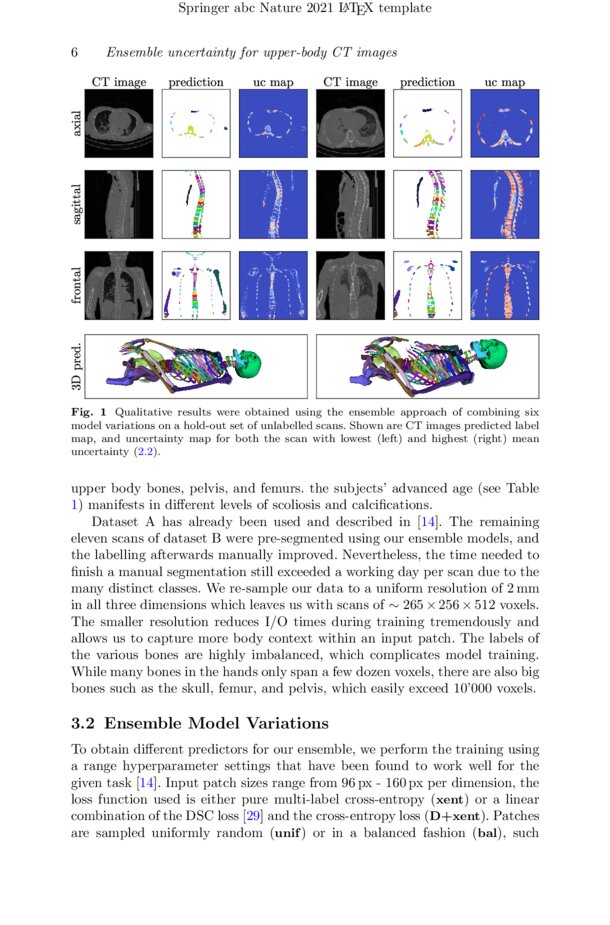 Ensemble uncertainty as a criterion for dataset expansion in distinct bone segmentation from ...