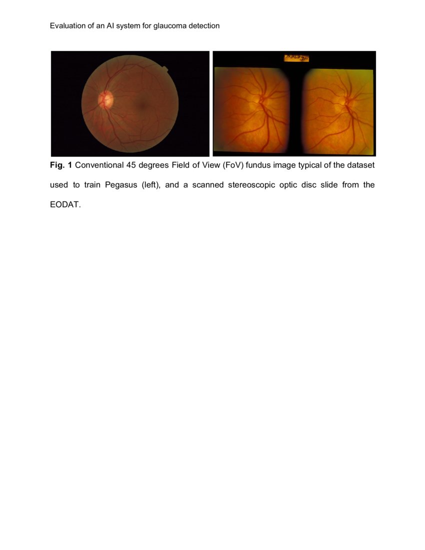 Evaluation Of An Ai System For The Automated Detection Of Glaucoma From Stereoscopic Optic Disc
