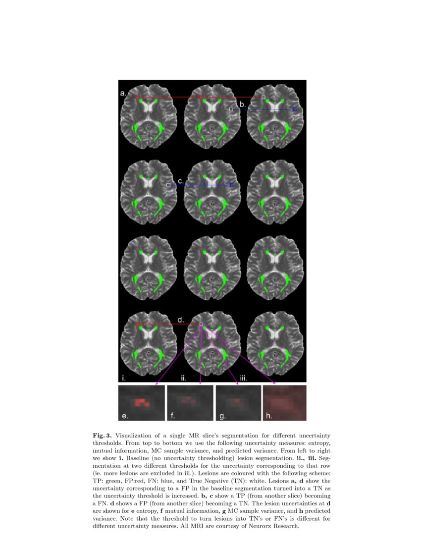 Exploring Uncertainty Measures in Deep Networks for Multiple Sclerosis Lesion Detection and ...