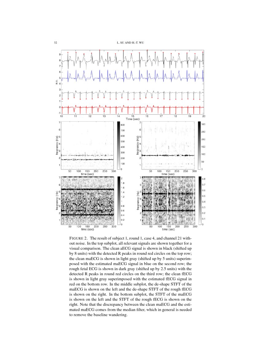 Extract Fetal Ecg From Single Lead Abdominal Ecg By De Shape Short Time Fourier Transform And
