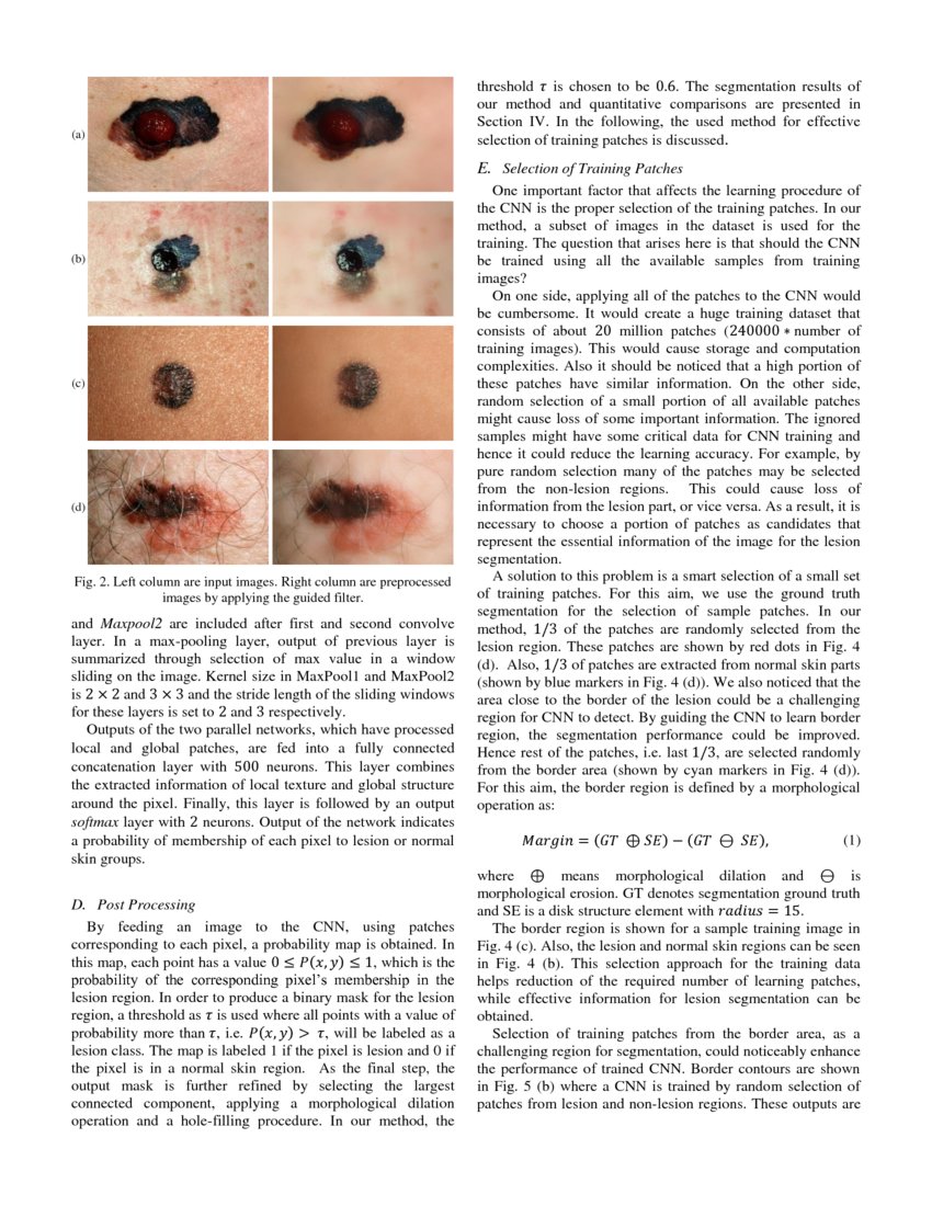 Extraction of Skin Lesions from Non-Dermoscopic Images Using Deep ...