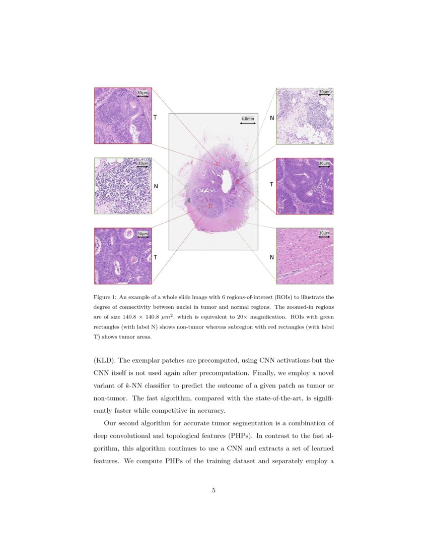 Fast and Accurate Tumor Segmentation of Histology Images using Persistent Homology and Deep ...