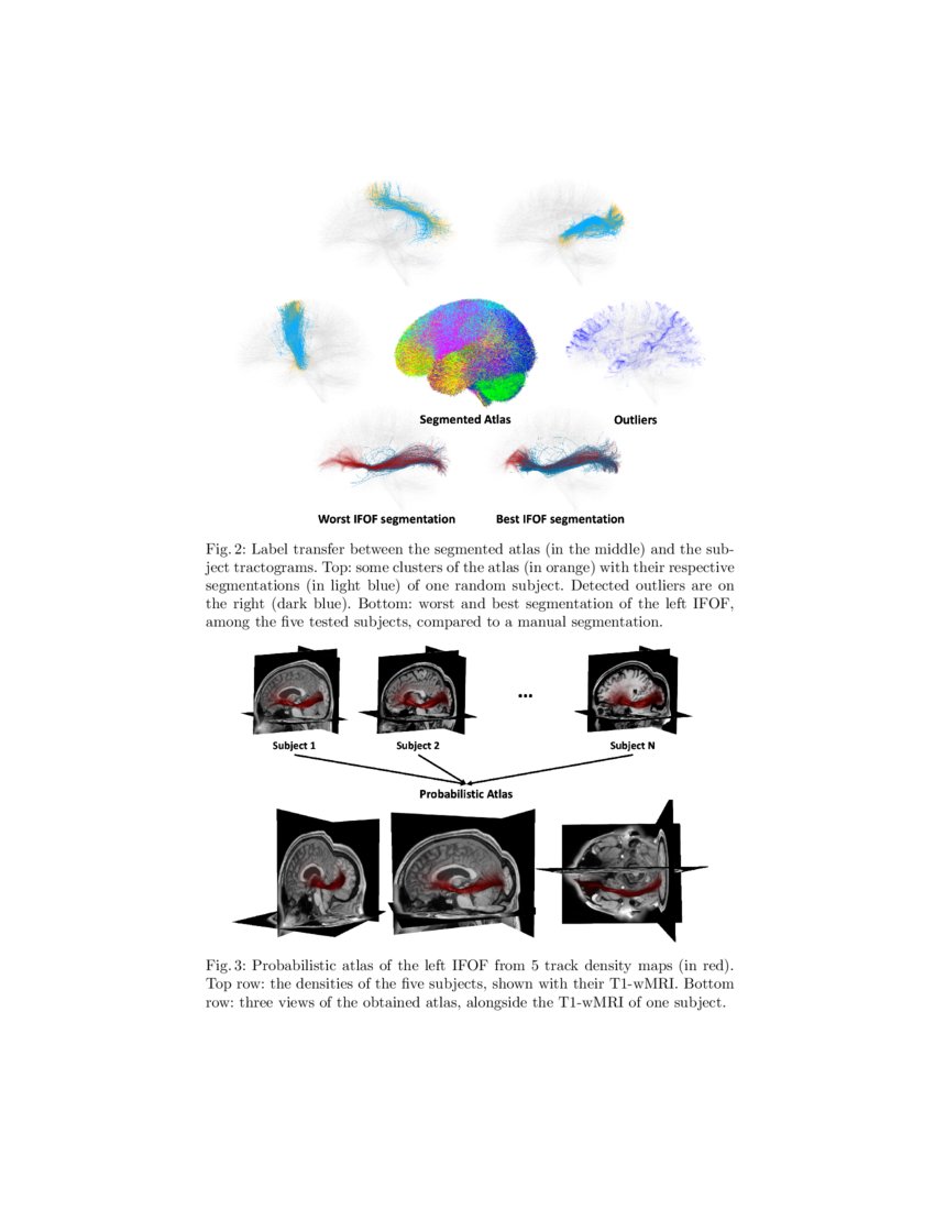 Fast and Scalable Optimal Transport for Brain Tractograms | DeepAI