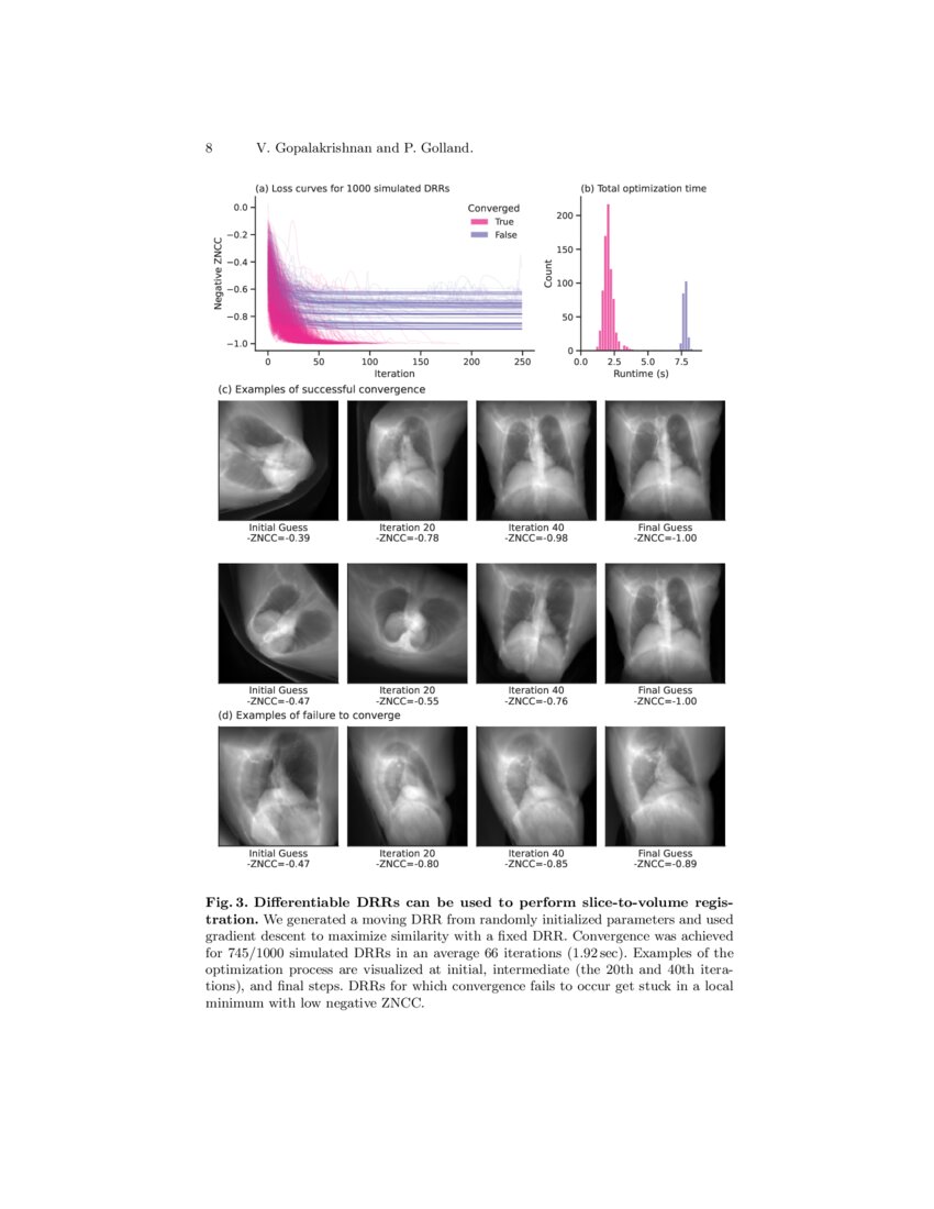 Fast Auto Differentiable Digitally Reconstructed Radiographs For