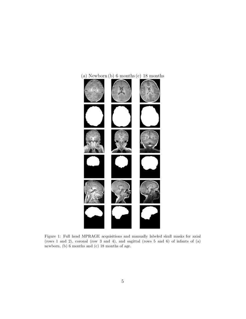 Fast Infant MRI Skullstripping with Multiview 2D Convolutional Neural ...