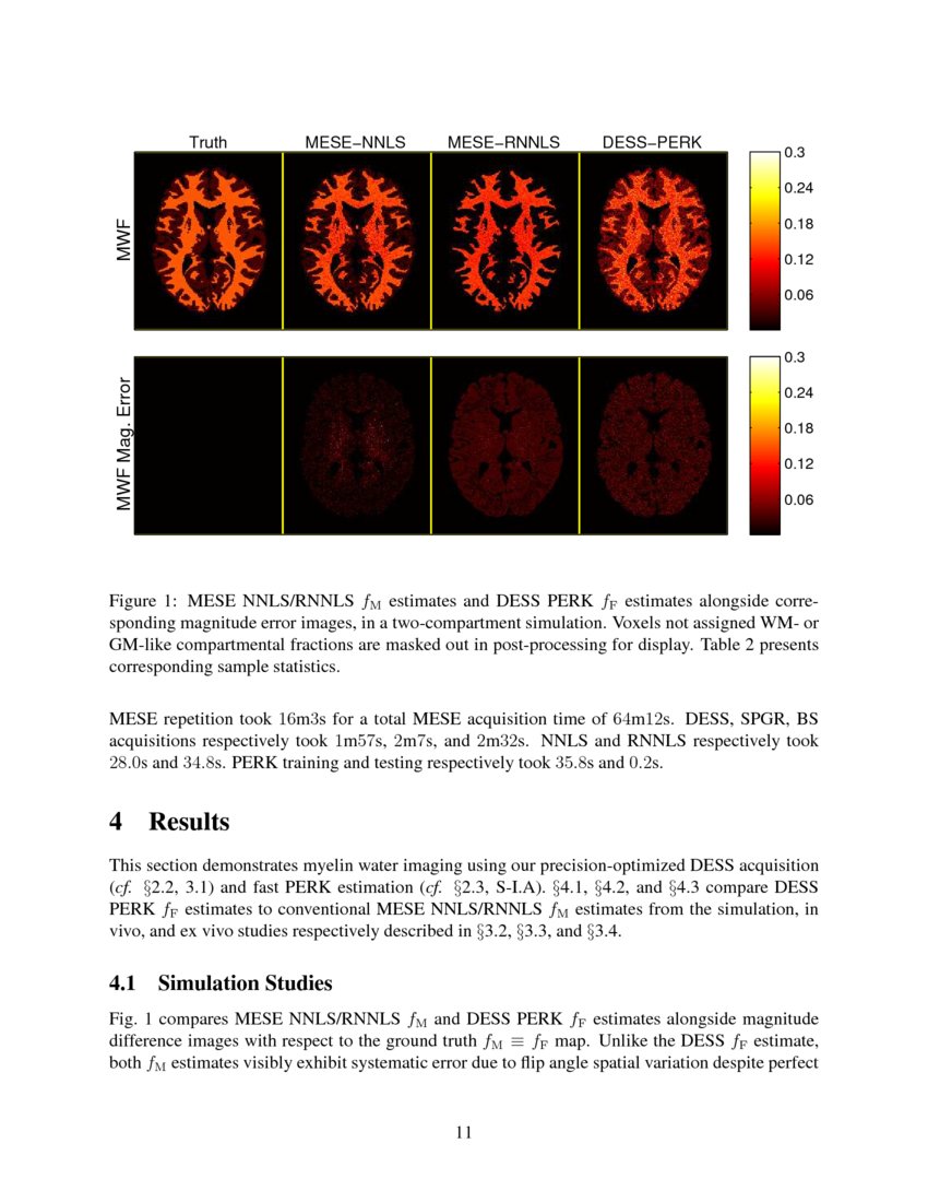 Fast, Precise Myelin Water Quantification using DESS MRI and Kernel ...