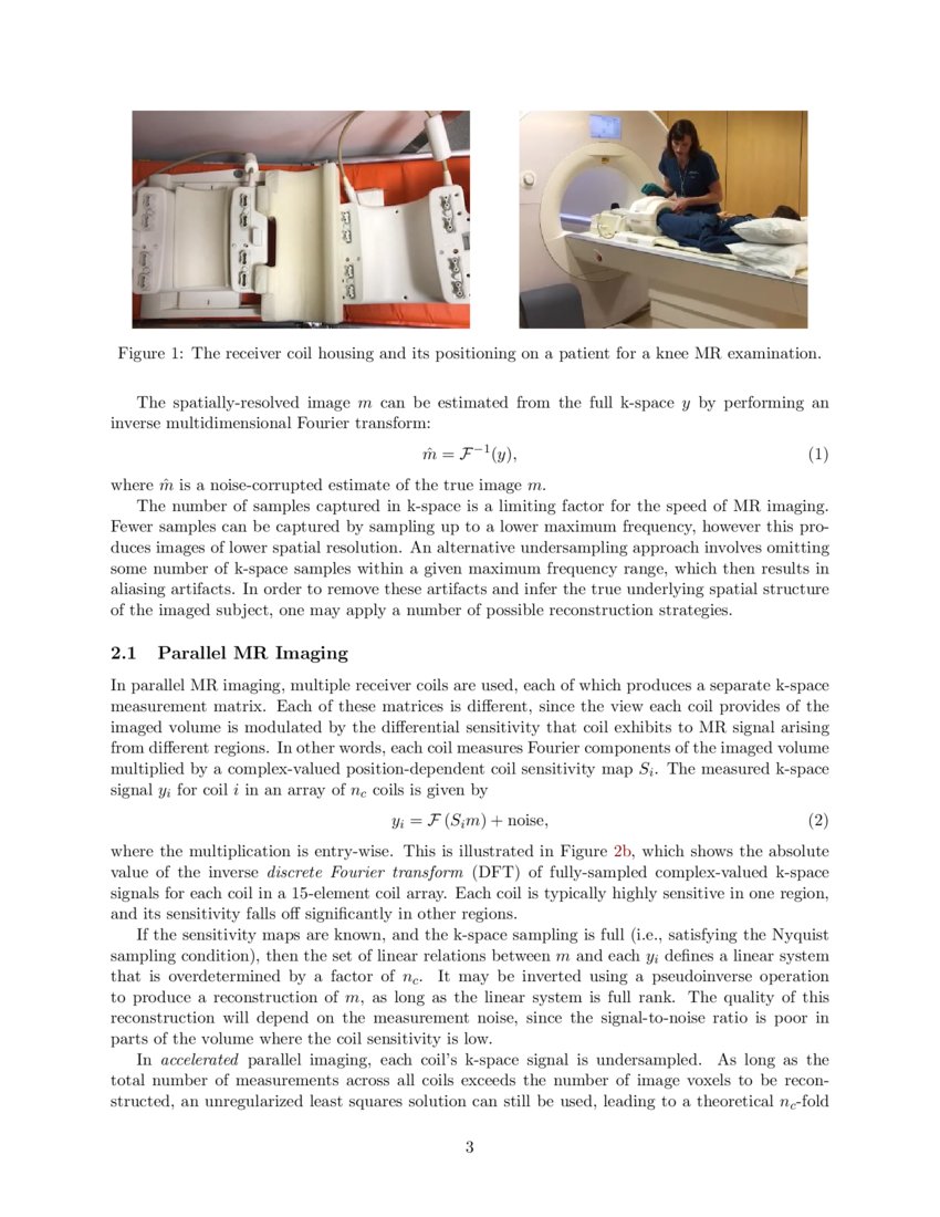 fastMRI: An Open Dataset and Benchmarks for Accelerated MRI | DeepAI
