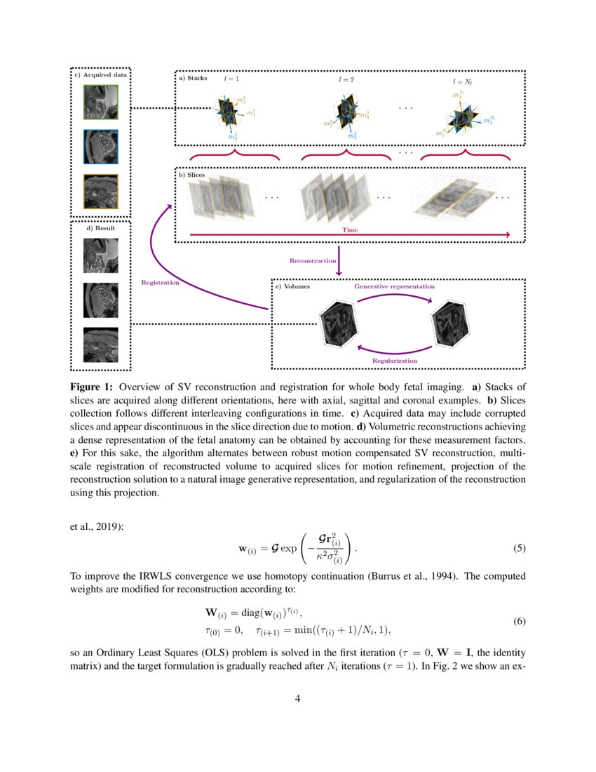 Fetal MRI by robust deep generative prior reconstruction and diffeomorphic registration ...