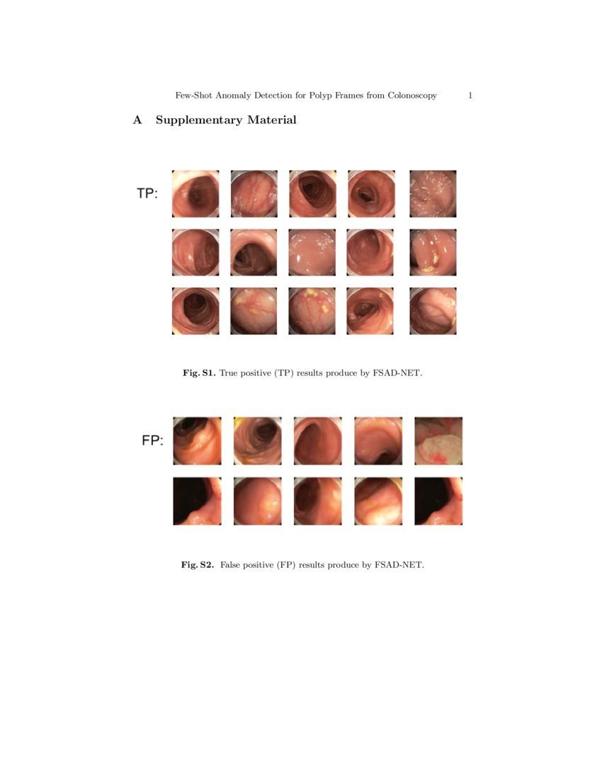 Few Shot Anomaly Detection For Polyp Frames From Colonoscopy Deepai