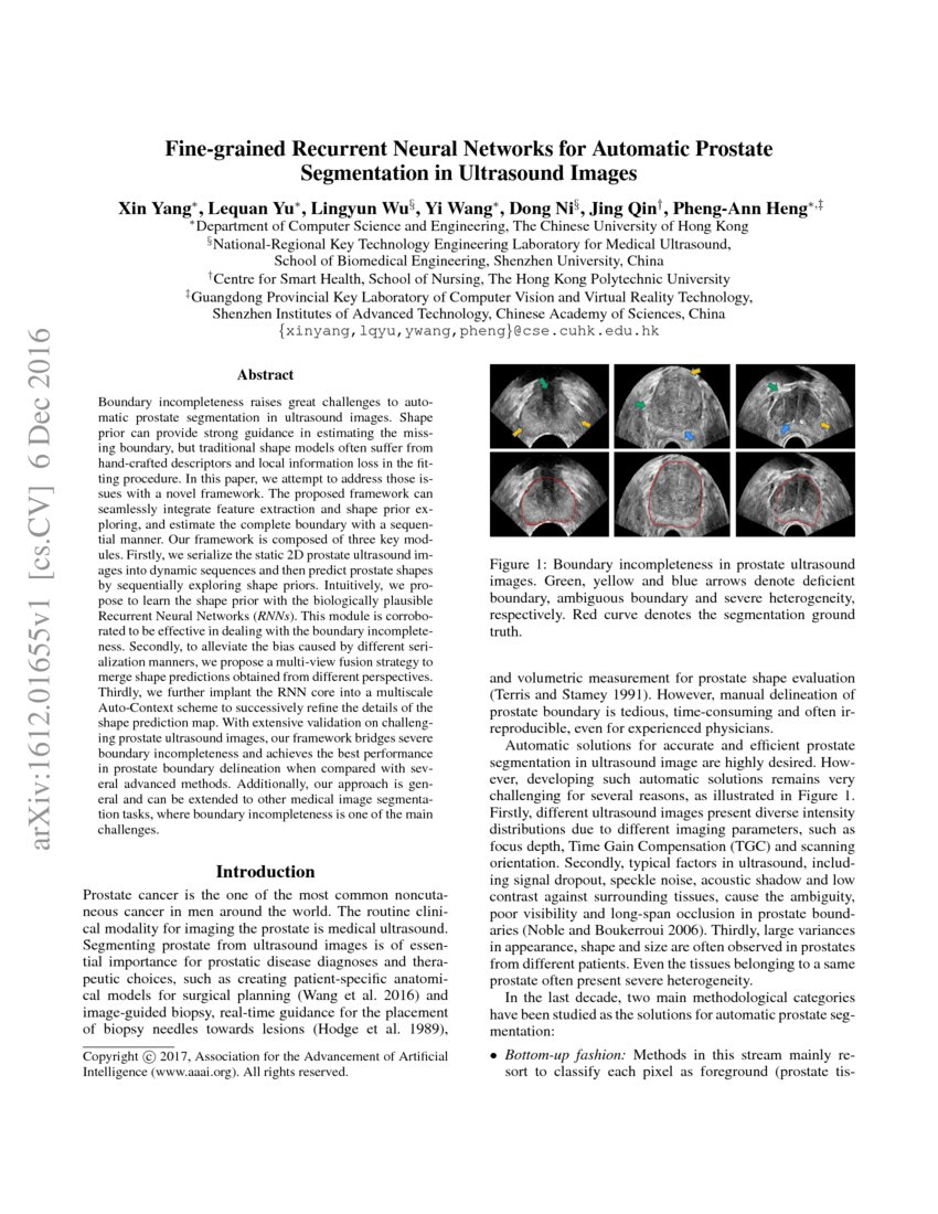 Fine Grained Recurrent Neural Networks For Automatic Prostate Segmentation In Ultrasound Images