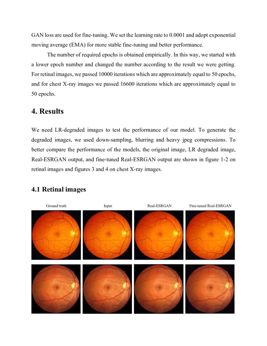 Fine-tuned Generative Adversarial Network-based Model for Medical ... Fine-tuned Generative Adversarial Network-based Model for Medical ...