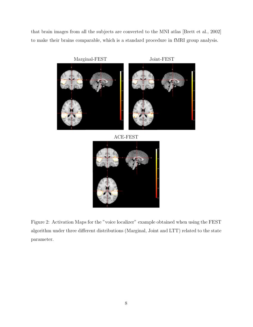 Fmri Group Analysis Based On Outputs From Matrix Variate Dynamic Linear Models Deepai 