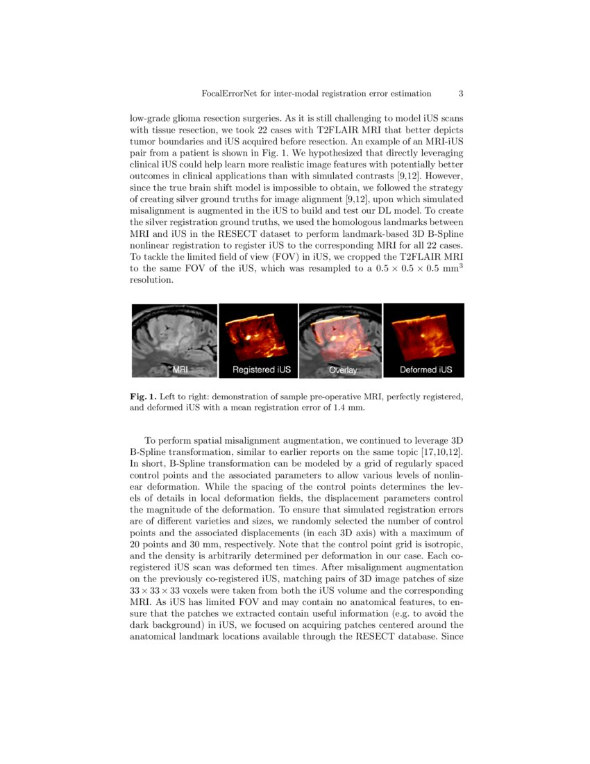 FocalErrorNet: Uncertainty-aware focal modulation network for inter ... FocalErrorNet: Uncertainty-aware focal modulation network for inter ...