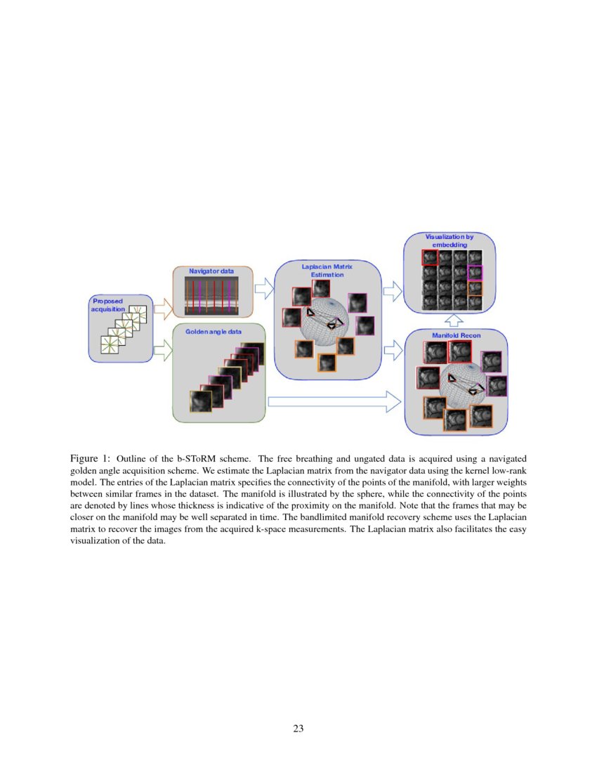 Free-breathing cardiac MRI using bandlimited manifold modelling | DeepAI