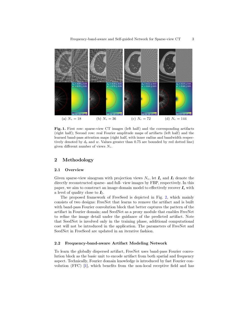 FreeSeed: Frequency-band-aware and Self-guided Network for Sparse-view CT Reconstruction | DeepAI