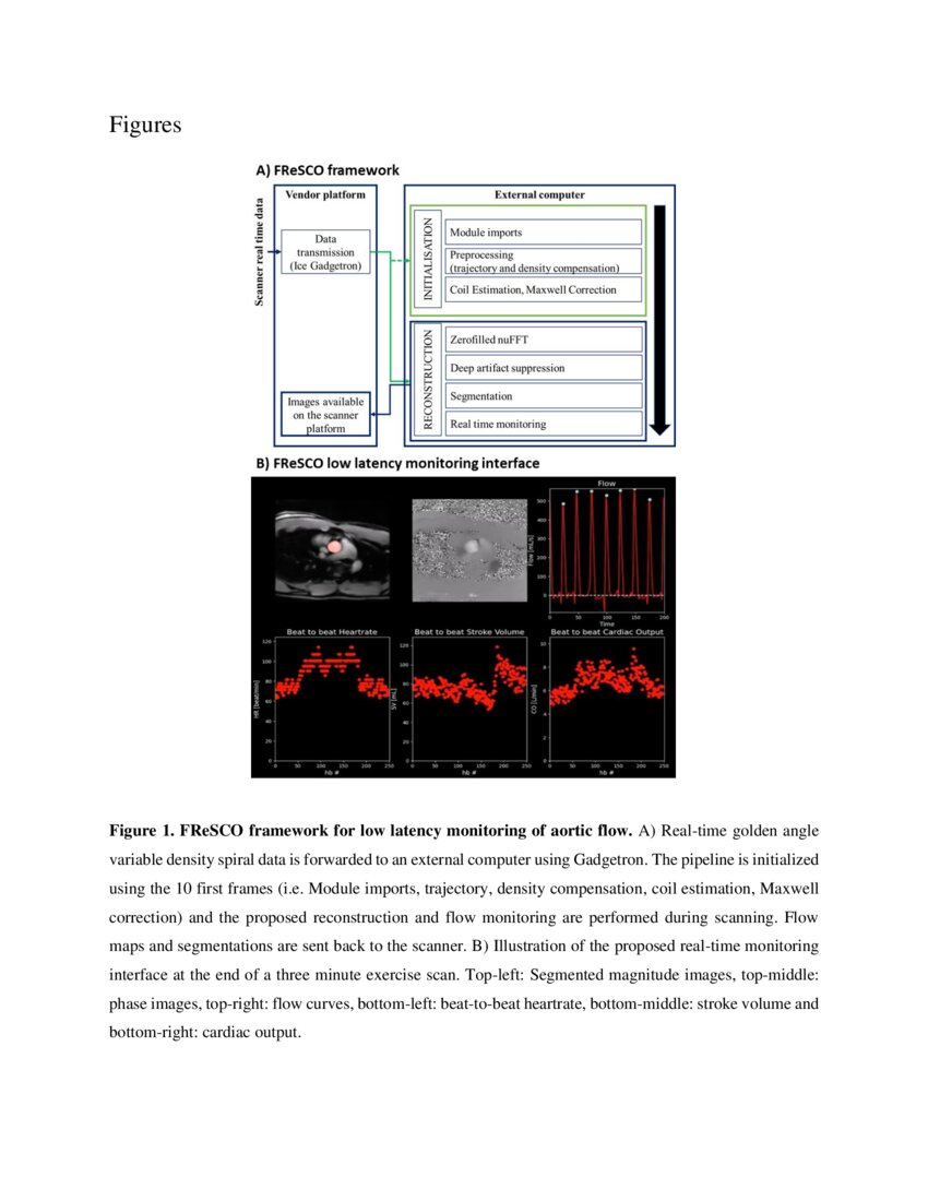 FReSCO: Flow Reconstruction and Segmentation for low latency Cardiac ...