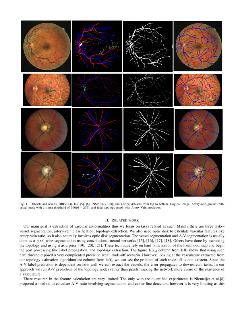 Fully Automated Artery Vein Ratio And Vascular Tortuosity Measurement