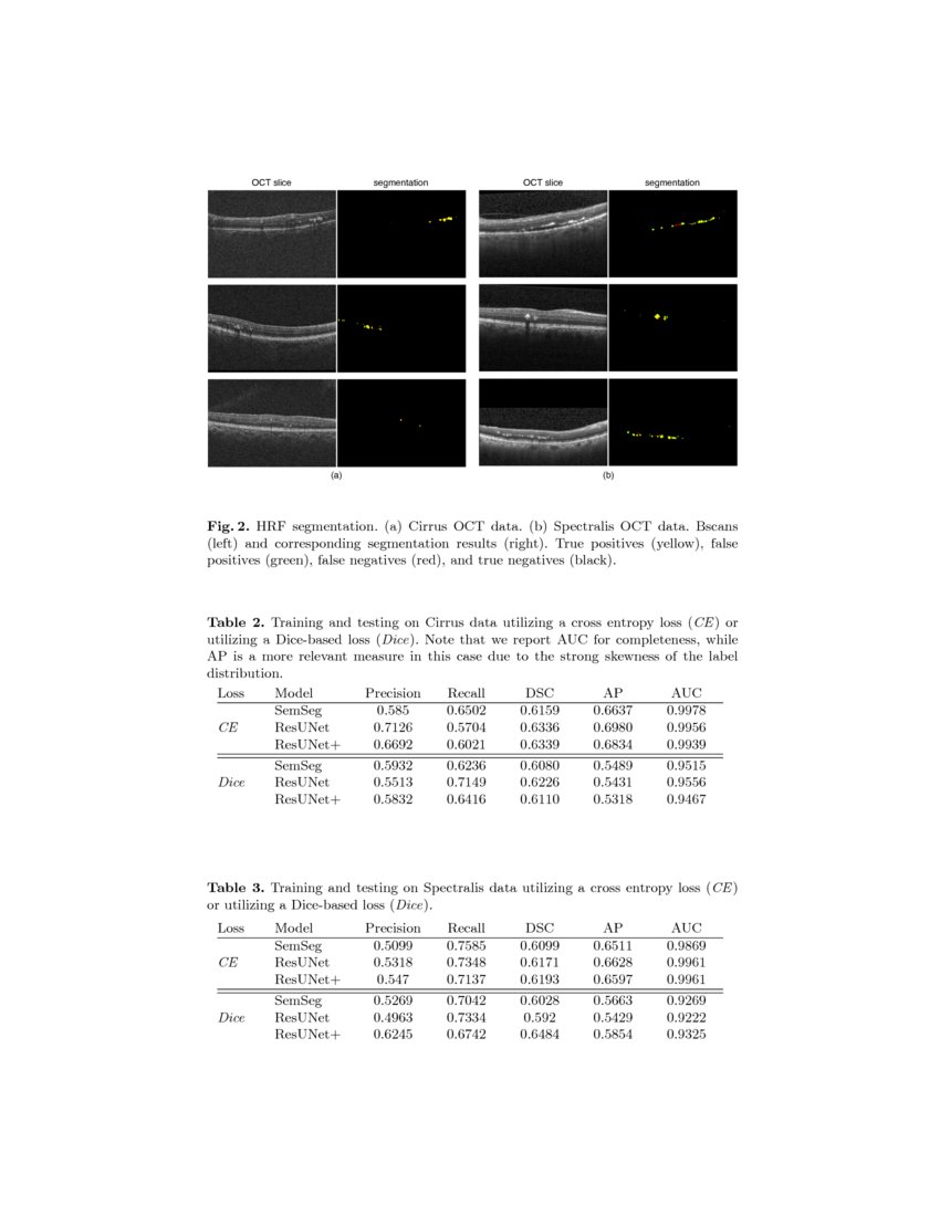 Fully Automated Segmentation of Hyperreflective Foci in Optical Coherence Tomography Images | DeepAI