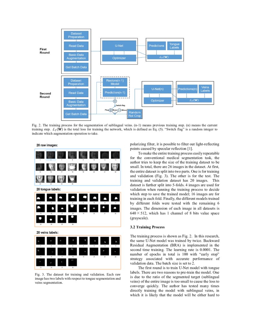 Fully Automatic Segmentation of Sublingual Veins from Retrained U-Net Model for Few Near ...