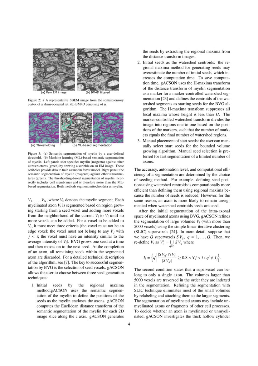 gACSON software for automated segmentation and morphology analyses of myelinated axons in 3D ...