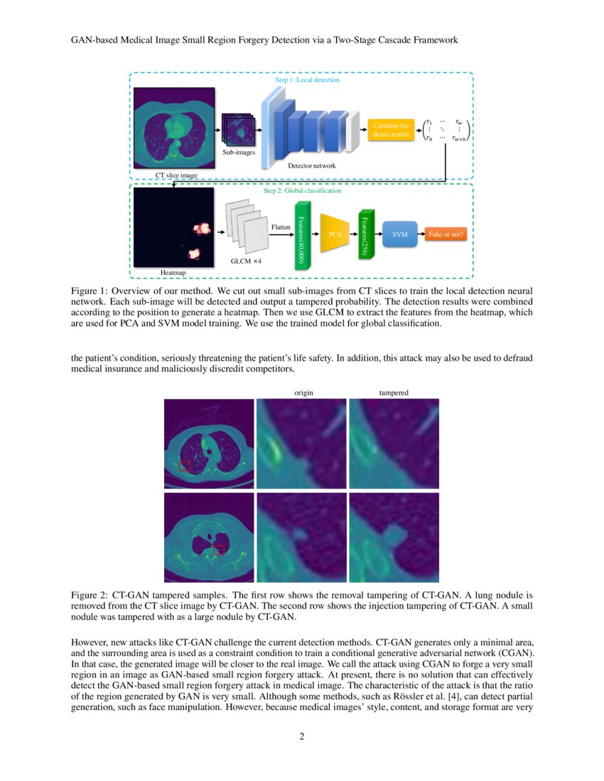 Gan Based Medical Image Small Region Forgery Detection Via A Two Stage