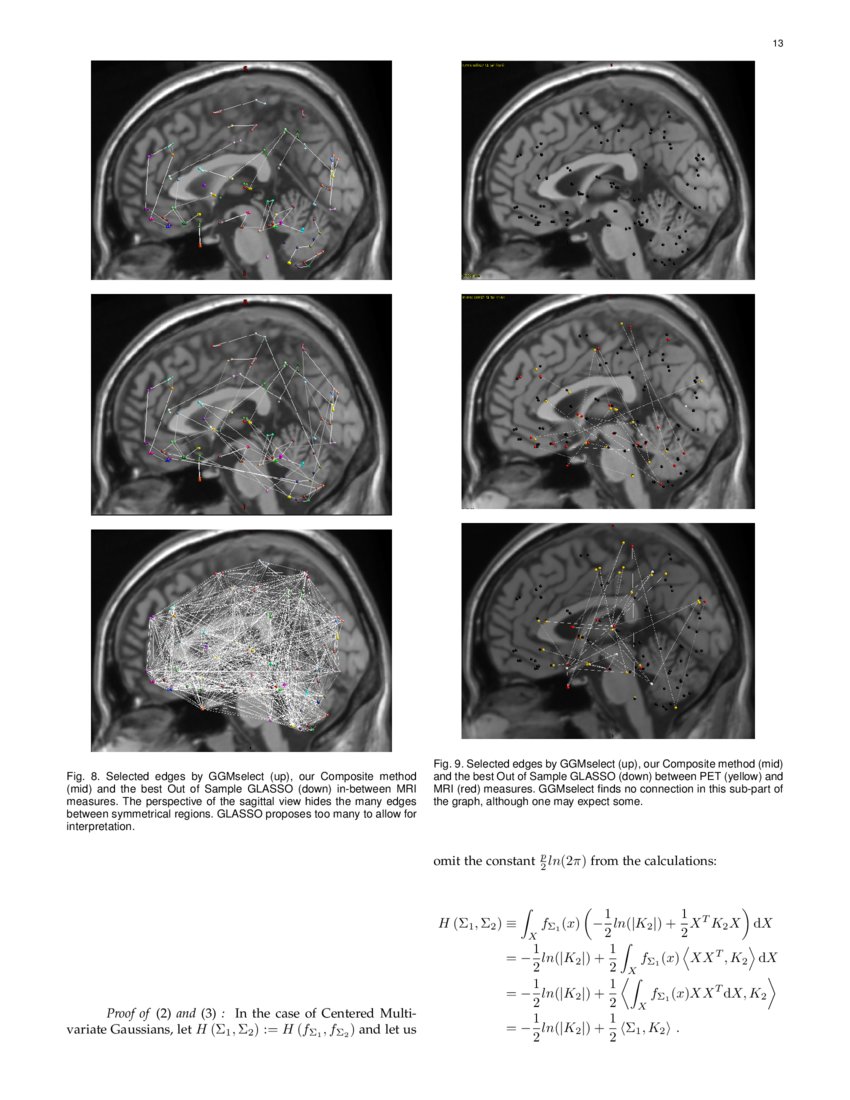 Gaussian Graphical Model Exploration And Selection In High Dimension Low Sample Size Setting