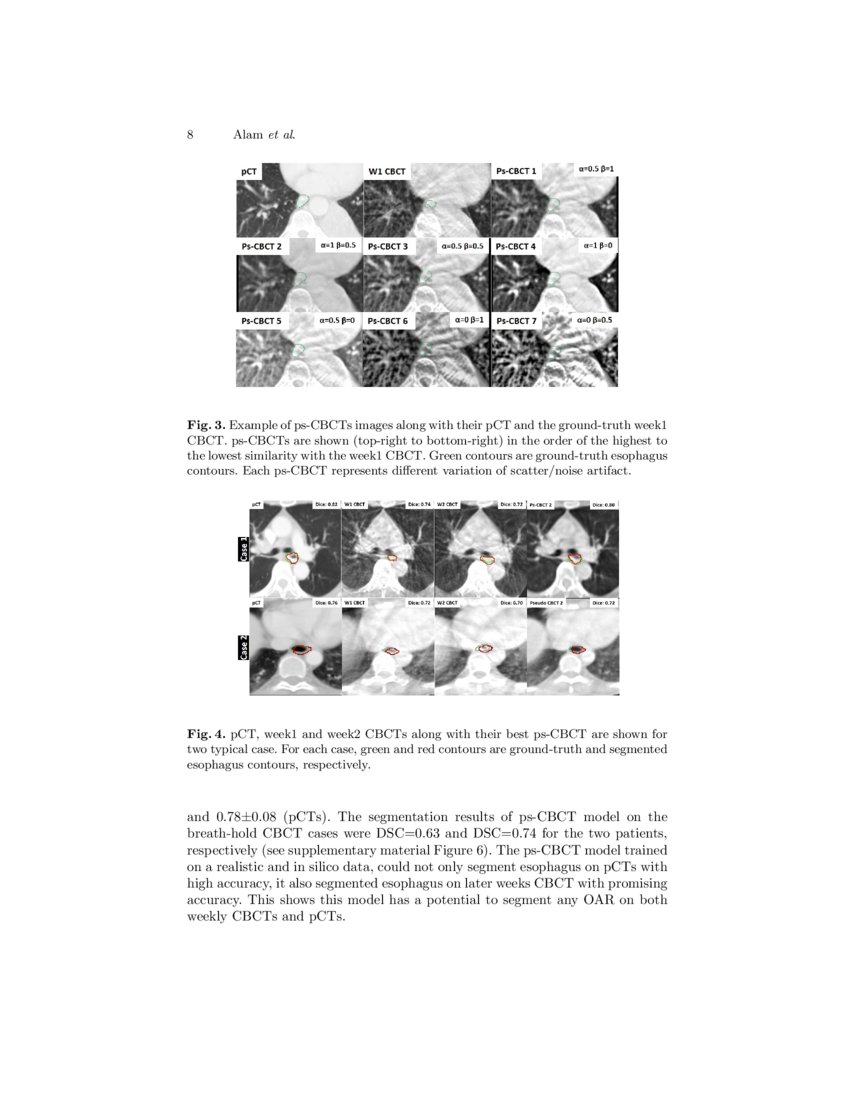 Generalizable Cone Beam CT Esophagus Segmentation Using In Silico Data Augmentation | DeepAI